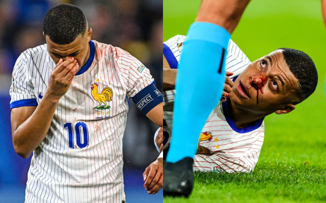 The Unfortunate Incident: Kylian Mbappe’s Nose Injury at Euro 2024 ...